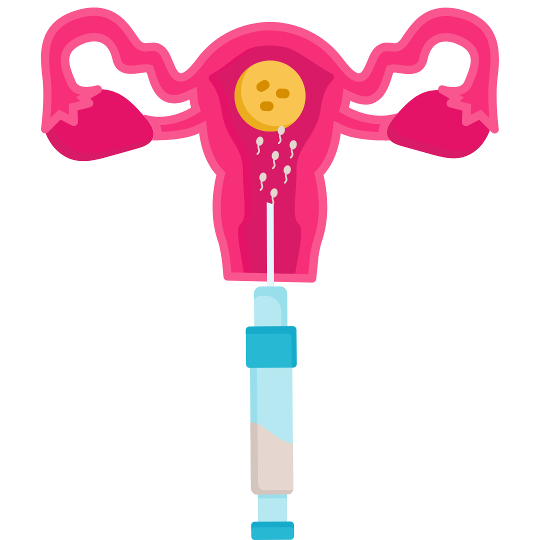 Entenda A Inseminação Artificial Da Preparação Ao Tratamento